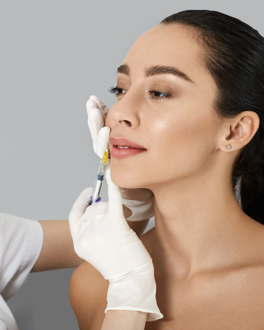 Botox Lip Flip in Buffalo, NY | Subtle Enhancement, Natural Results